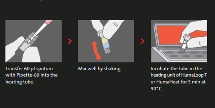 Tekmax - TB Lamp Technique